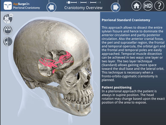App Shopper: Pterional Craniotomy (Medical)
