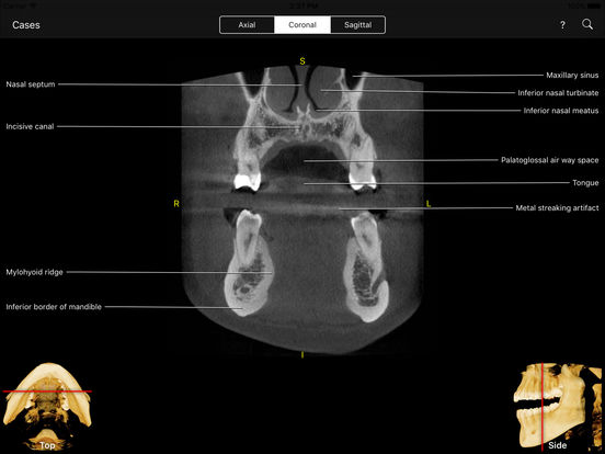 CBCT